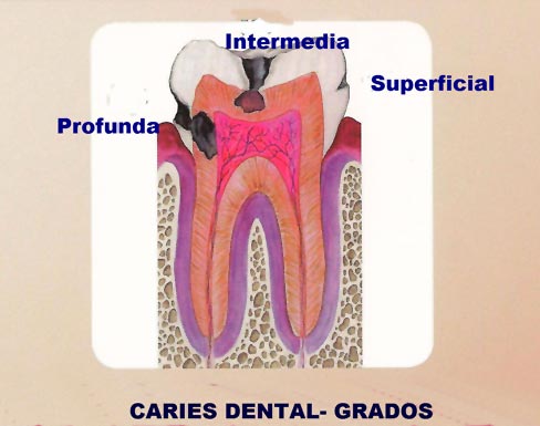 Odontologia General - Dentistas Valdemoro - Albelu